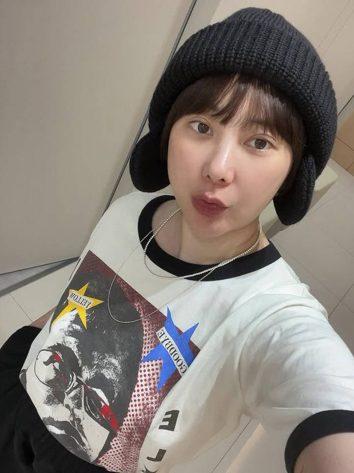 다이어트한 스타들 | 서인영, 10㎏ 체중 증가·코 보형물 제거 고백 `원래 38㎏인데 쪘다` : ZUM 뉴스