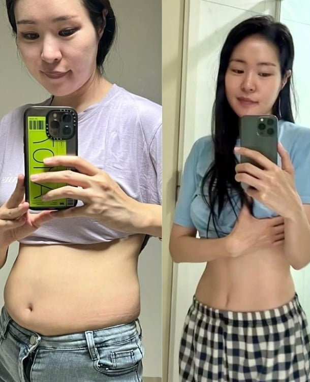 다이어트한 스타들 | `♥김태현` 미자, 접히던 뱃살 어디 갔나…독한 다이어트 성공 `80kg에서 40kg 대까지` : ZUM 뉴스