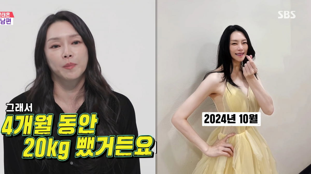 다이어트한 스타들 | `병약미 추구` 차지연, 4개월간 20kg 감량…♥남편도 이해불가[`동상이몽2`] : ZUM 뉴스